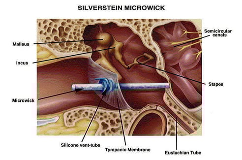 Ear Research Foundation | Research to End Hearing & Balance Disorders