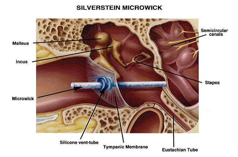 Ear Research Foundation | Research to End Hearing & Balance Disorders